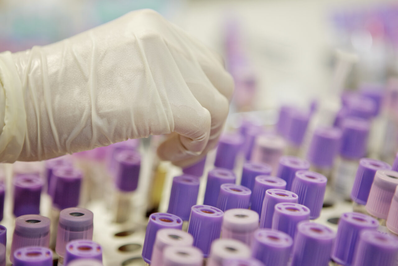 Banco de Células Madre de Cordón Umbilical | BioCord